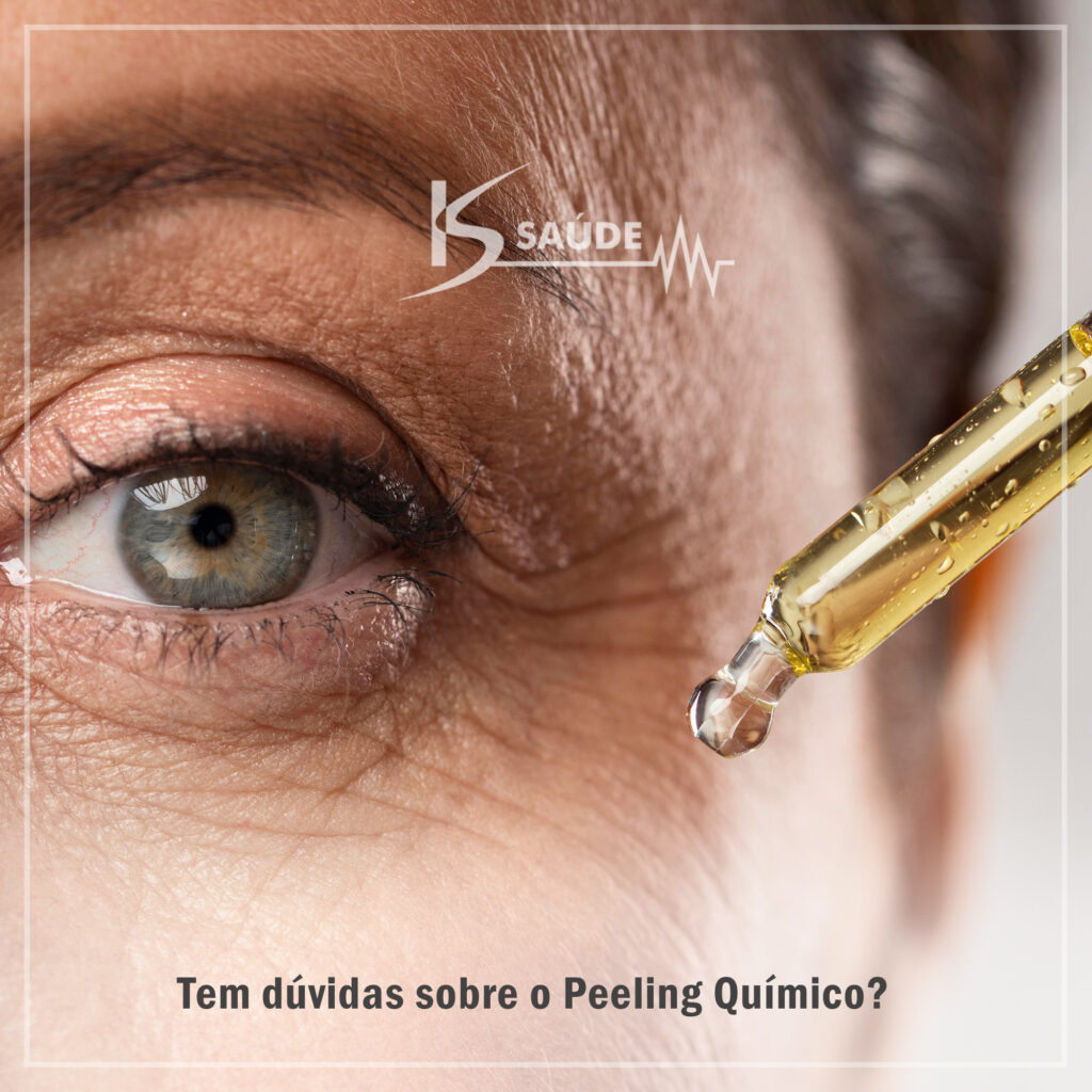 Tem dúvidas sobre o Peeling Químico? - kssaude.com.br