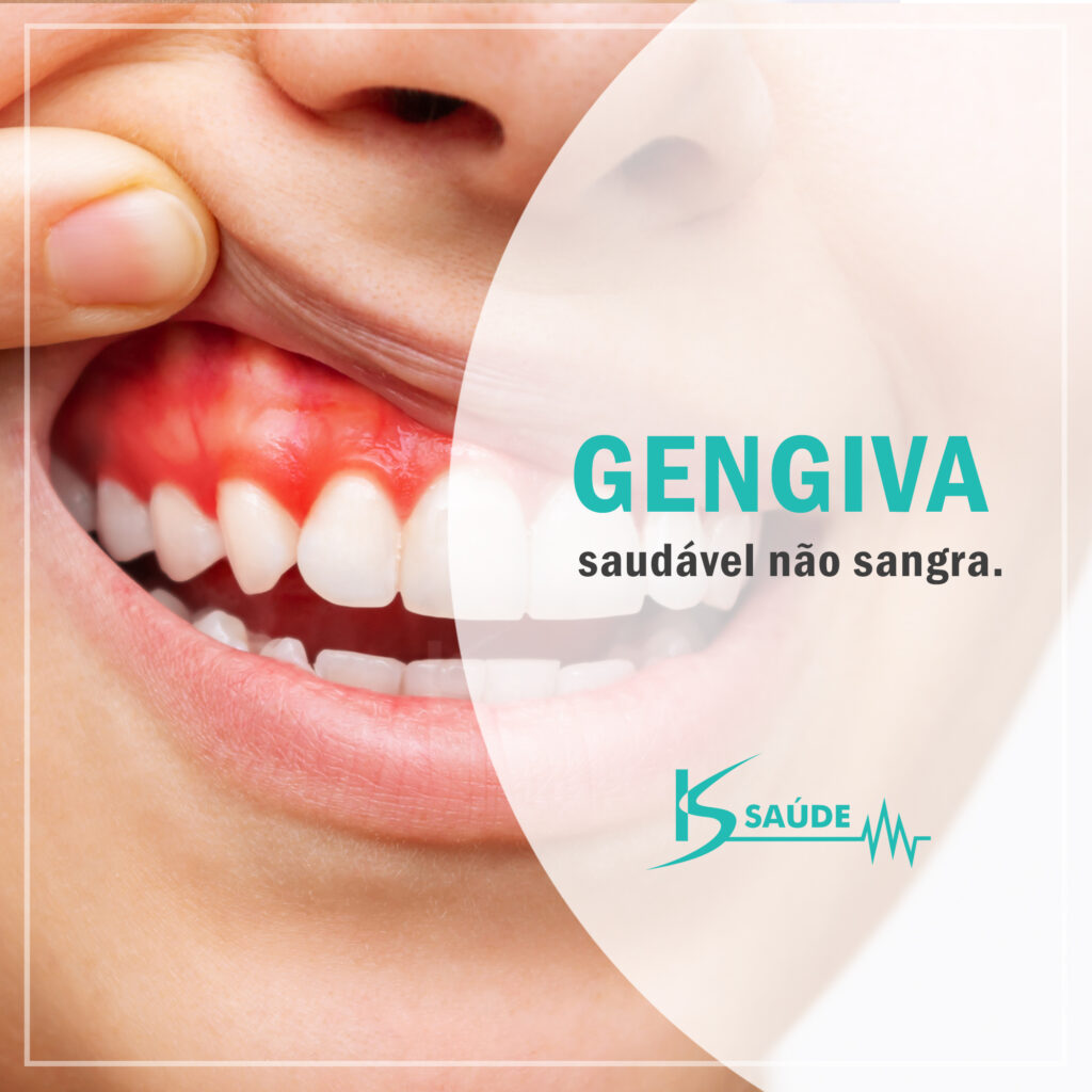 Gengiva Saudável não sangra, sabia? - kssaude.com.br